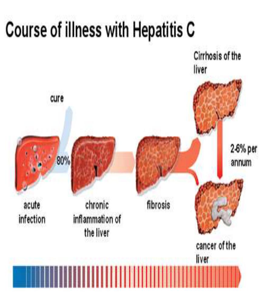 Hepatitis | Flashcards