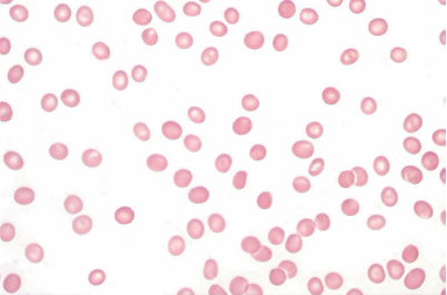 Anemia Andy’s Quizlet | Flashcards